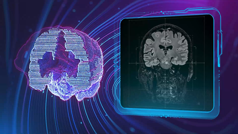 FDA Clears GE Healthcare’s AIR Recon DL for 3D and Motion-Insensitive ...