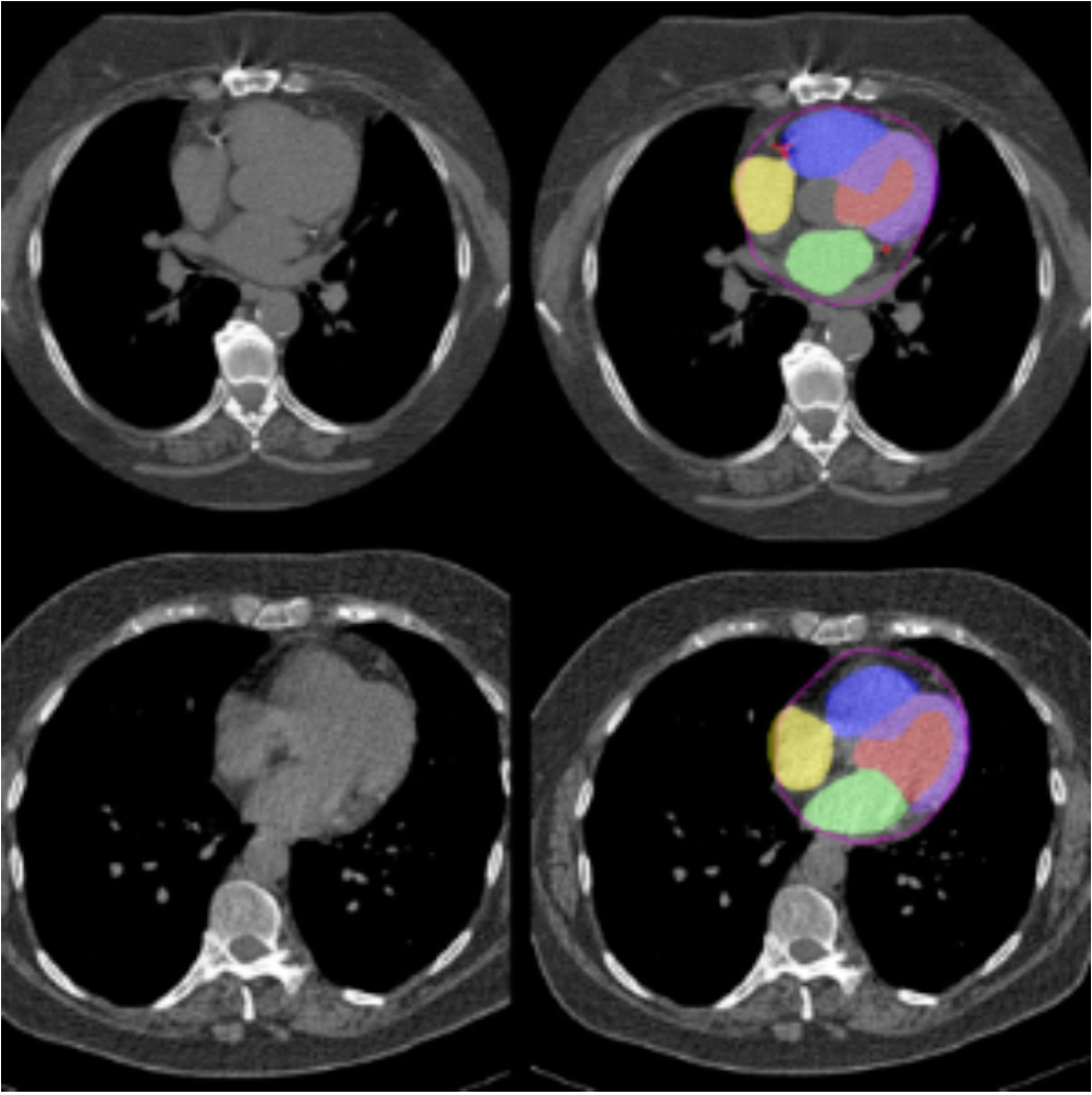 articles • APPLIED RADIOLOGY