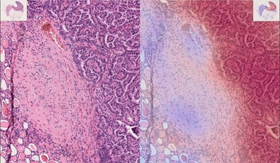 Using Explainable AI For Medical Image Processing and Cancer Screening ...