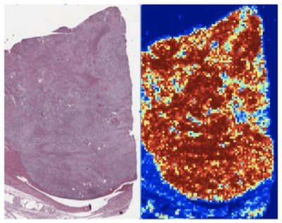 Using Explainable AI For Medical Image Processing and Cancer Screening ...