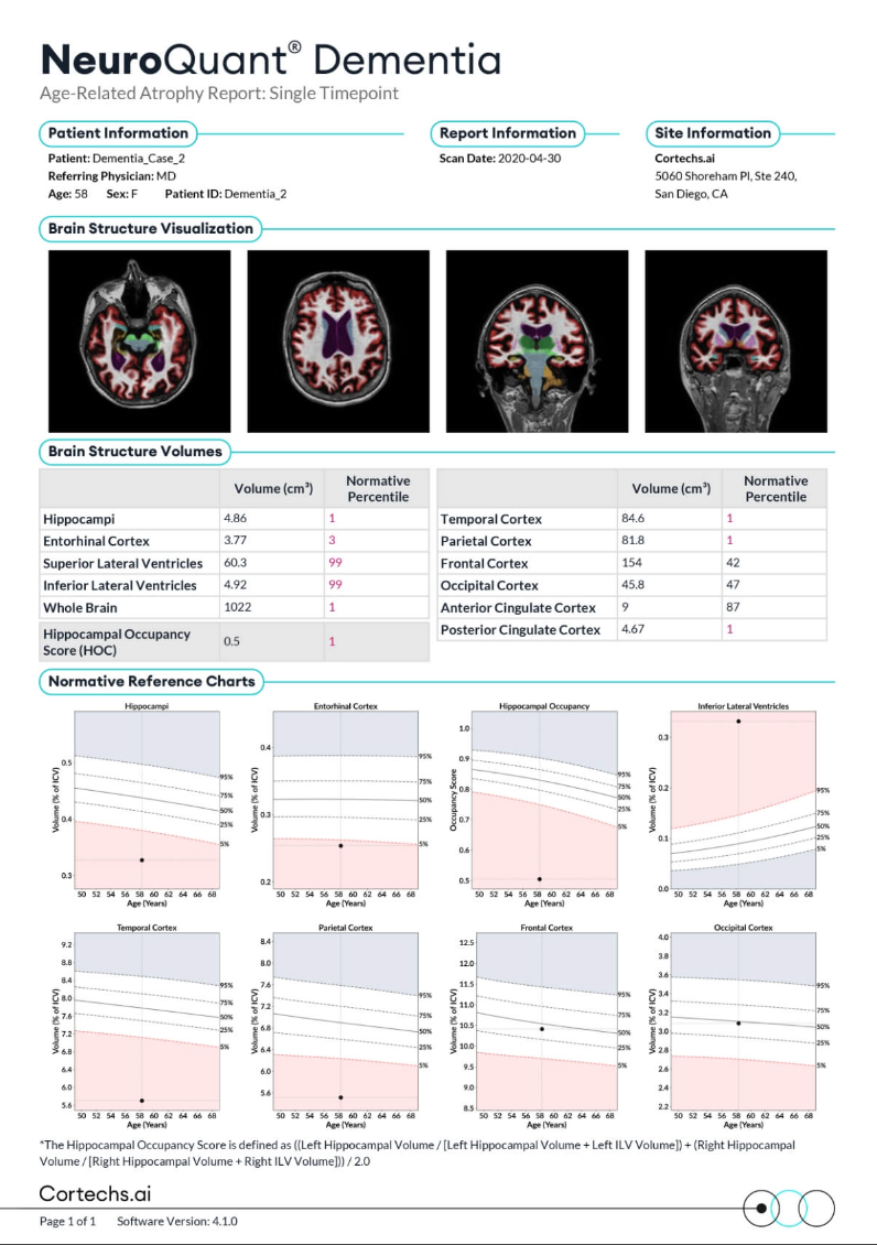 Cortechs.ai Nets FDA Clearance for NeuroQuant 5.0 with Improved ARIA ...