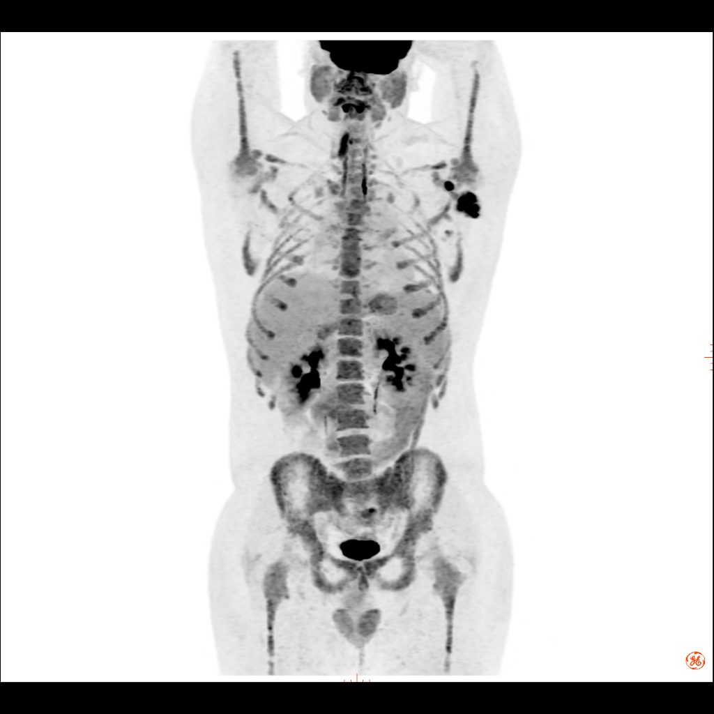 GE HealthCare Launches Sonic DL for up to 12 Times Faster MR Imaging ...