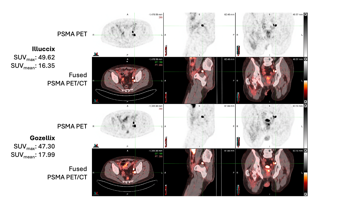 Leveraging Illuccix’s® Established Imaging Performance: An ...
