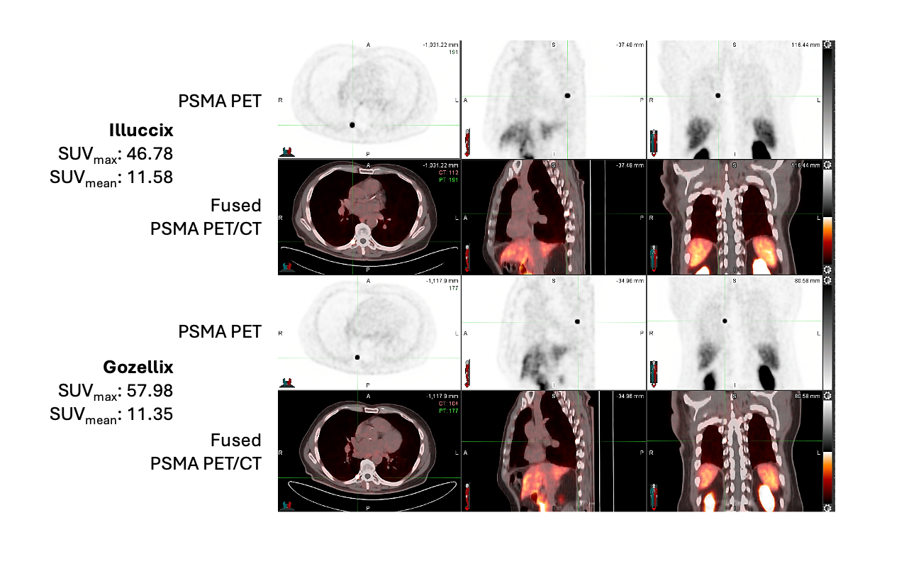 Leveraging Illuccix’s® Established Imaging Performance: An ...