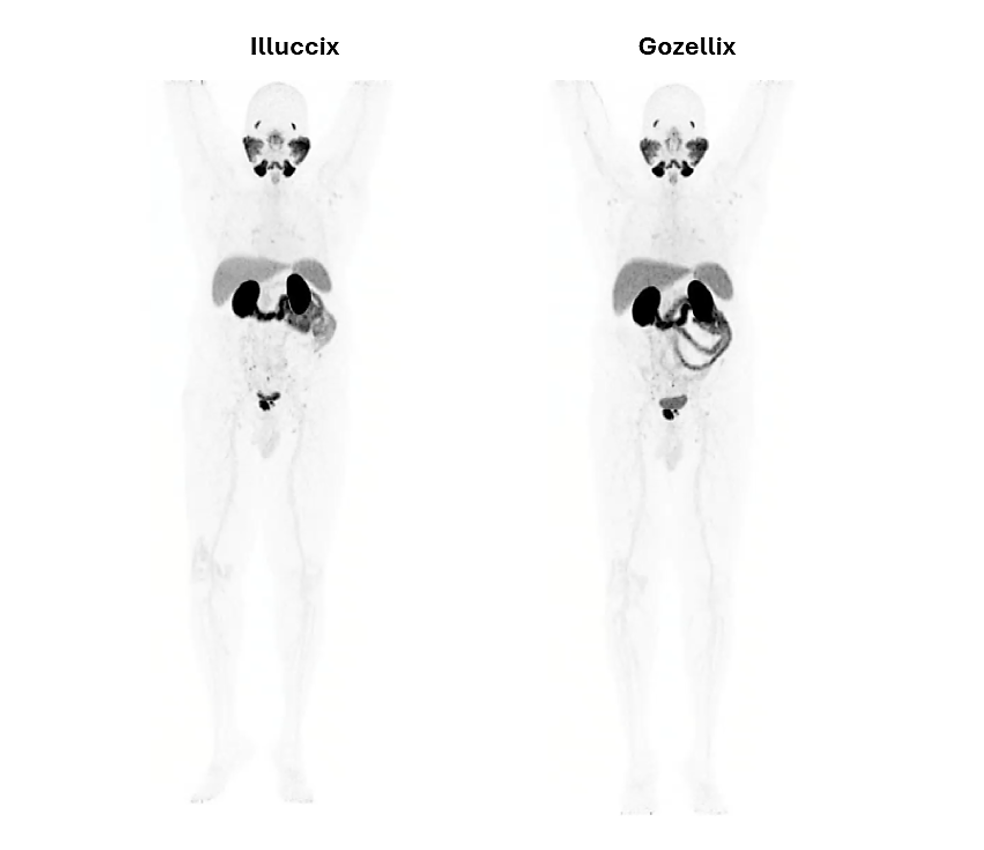 Leveraging Illuccix’s® Established Imaging Performance: An ...