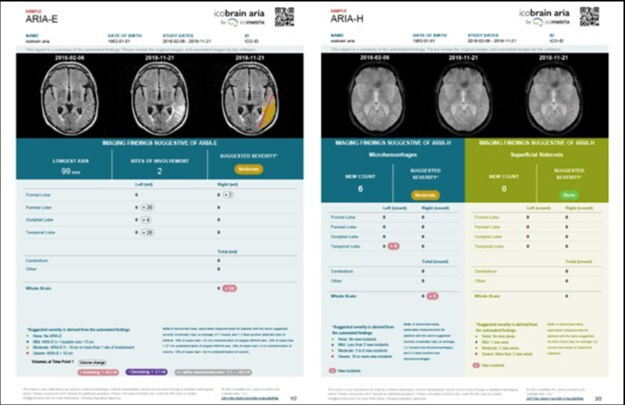 Philips, icometrix Team Up on AI-Driven MR Neuro Solution | Applied ...