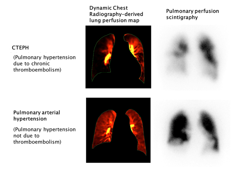 Dr Yamasaki Receives RSNA Cum Laude Award for Dynamic Digital ...