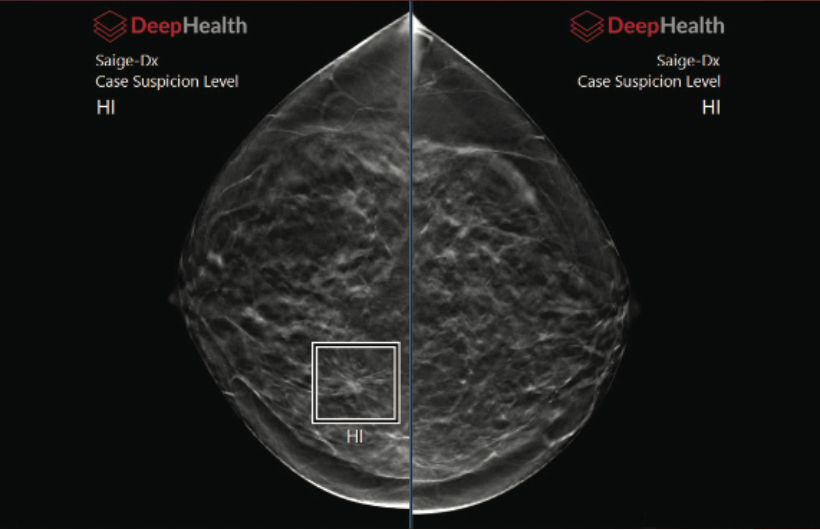 RadNet’s DeepHealth Launches AI-Powered Informatics | Applied Radiology