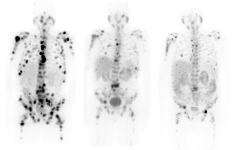 GE Introduces New Solid Target Platform for Cyclotron to Increase 68Ga ...