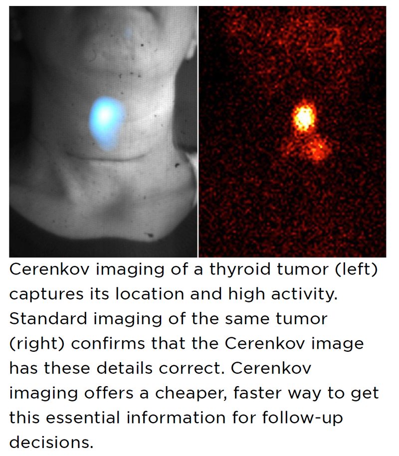 Imaging Technique May Improve Cancer Screening and Diagnosis in Rural ...