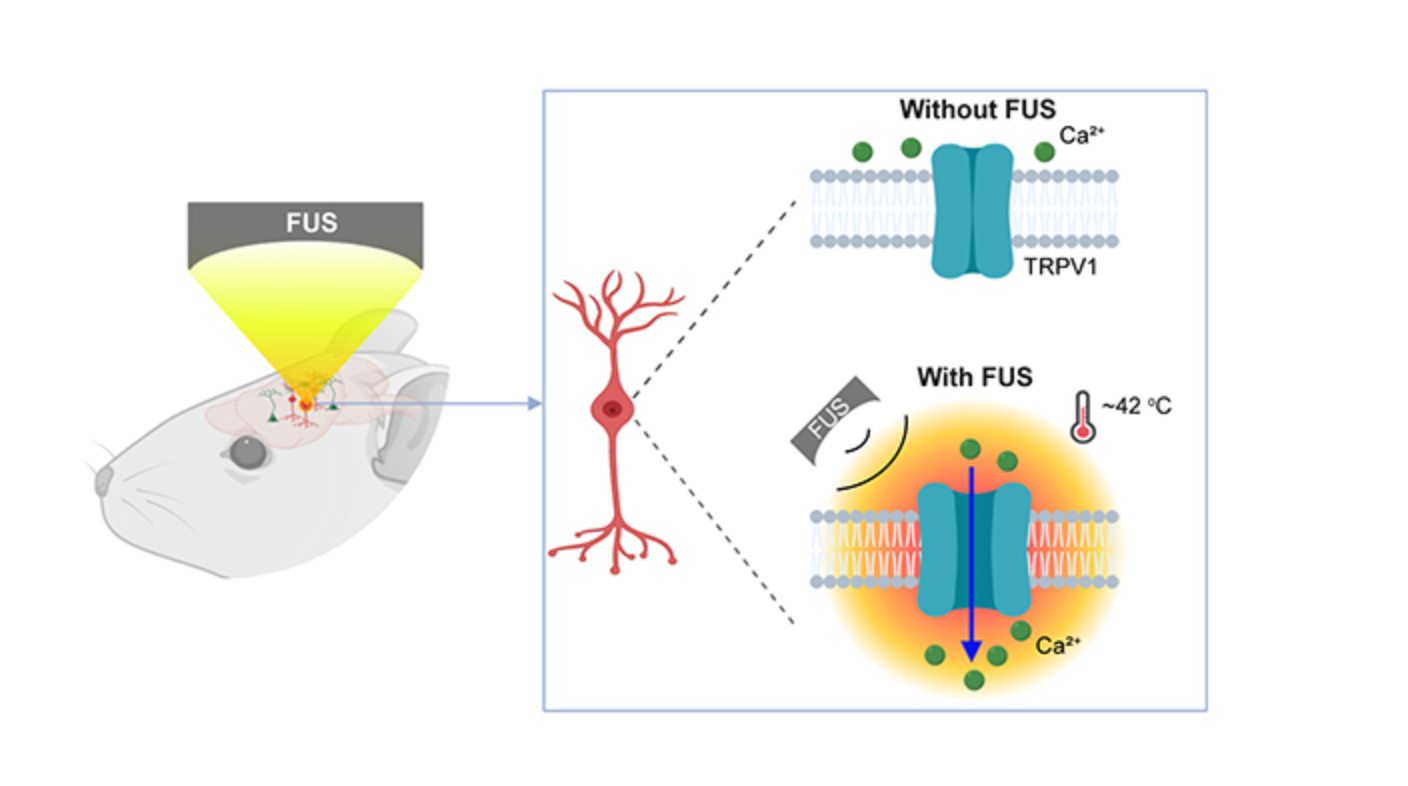 Stimulation Technique Uses Focused Ultrasound and Genetics to Activate ...