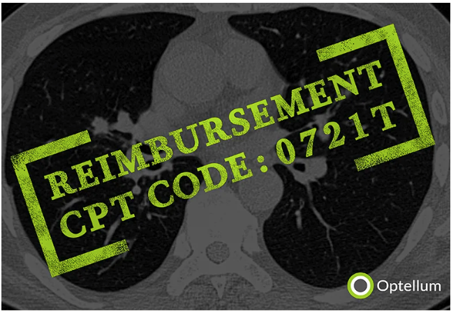 Optellum Lung Cancer Prediction Technology Gets CMS Payment ...