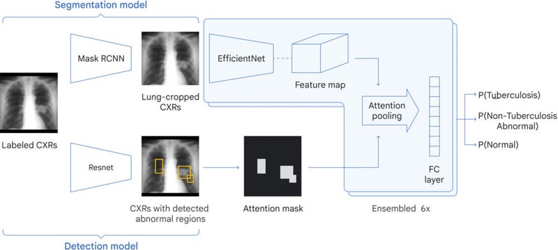 AI-Based System Comparable to Radiologists in Tuberculosis Detection ...