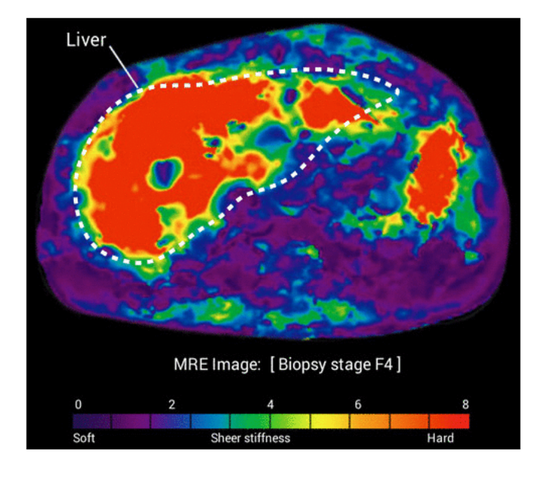 Canon Launches Open Bore 1.5T MRI, Partners with Resoundant for MR ...