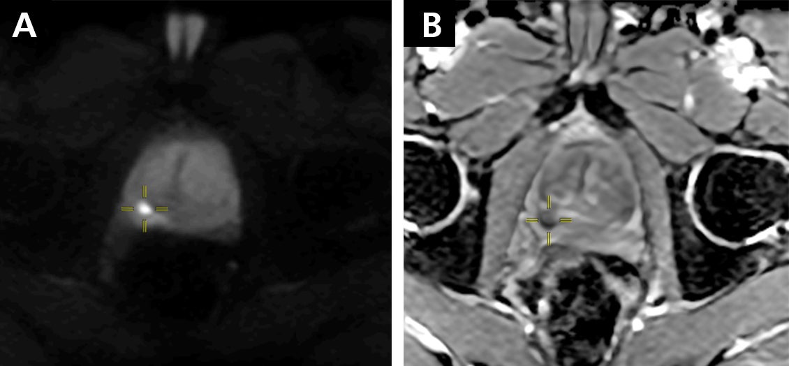 SDMI Sizes Up: New Canon 3T Supreme MRI Delivers Quality, Comfort, and ...