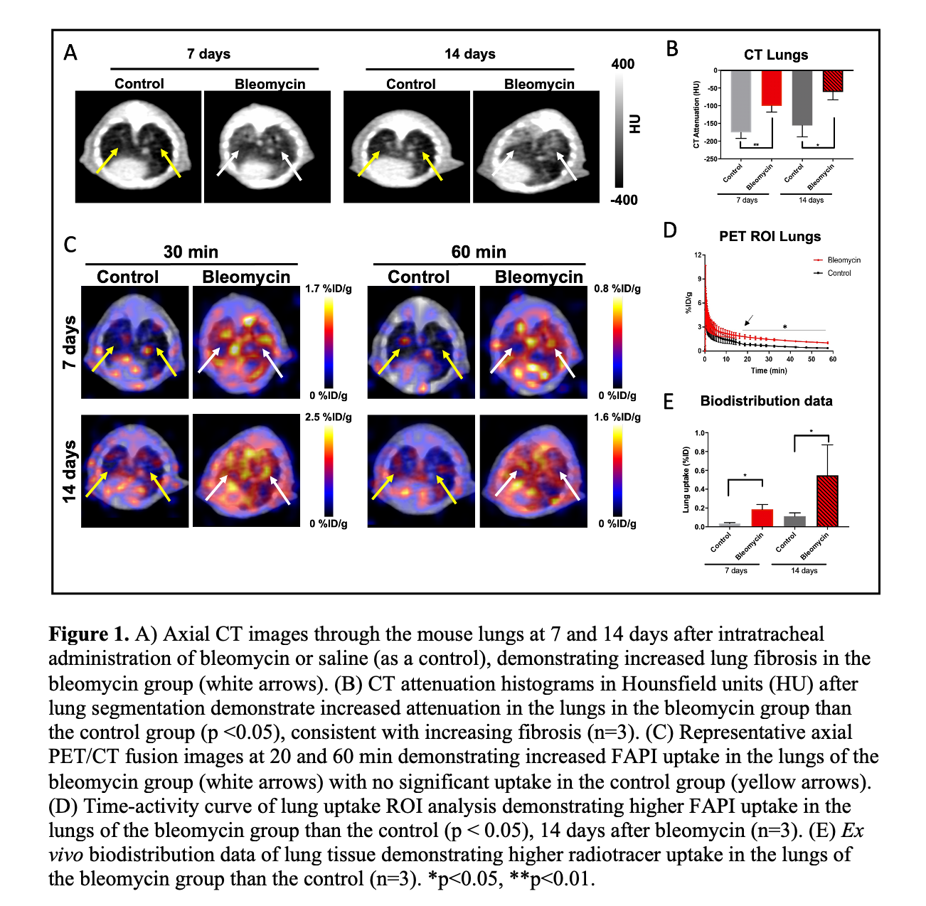 SNMMI ’21: 68Ga-FAPI-PET Non-invasively Detects, Assesses Pulmonary ...