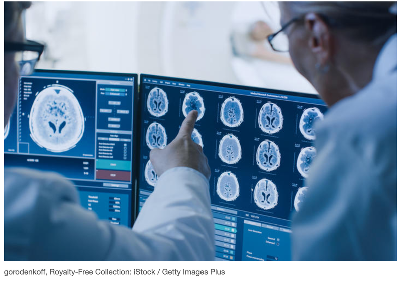 Radiologists Concerned With Contrast Agent Availability as MRI ...