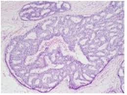 Imaging Method Leads to Better Detection of Cancer in Mice Dense ...