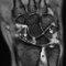 MRI of the wrist