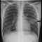 Article - Pediatric chest: A review of the must-know diagnoses