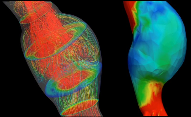 Nectero Medical to Initiate Phase II/III Study on Endovascular System ...