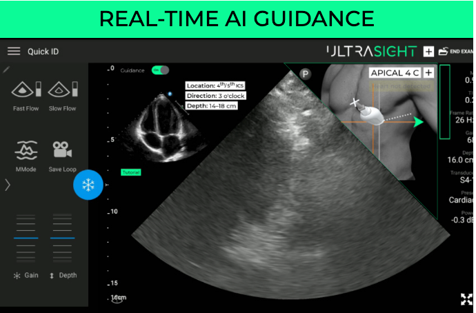 FDA Clears UltraSight’s AI-Powered Cardiac Ultrasound Software ...