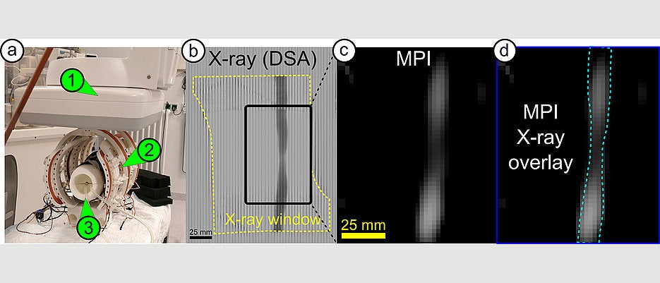 Scientists Develop Portable Magnetic Particle Imaging Scanner | Applied ...