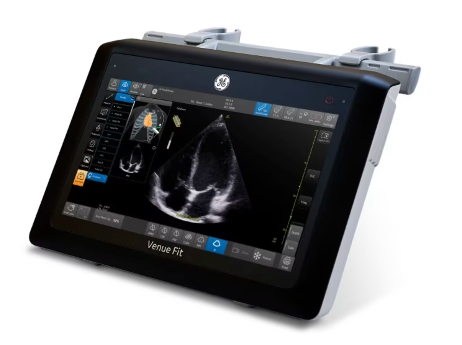 GE HealthCare Adds AI-Driven, Real-Time Guidance to Ultrasound Systems ...