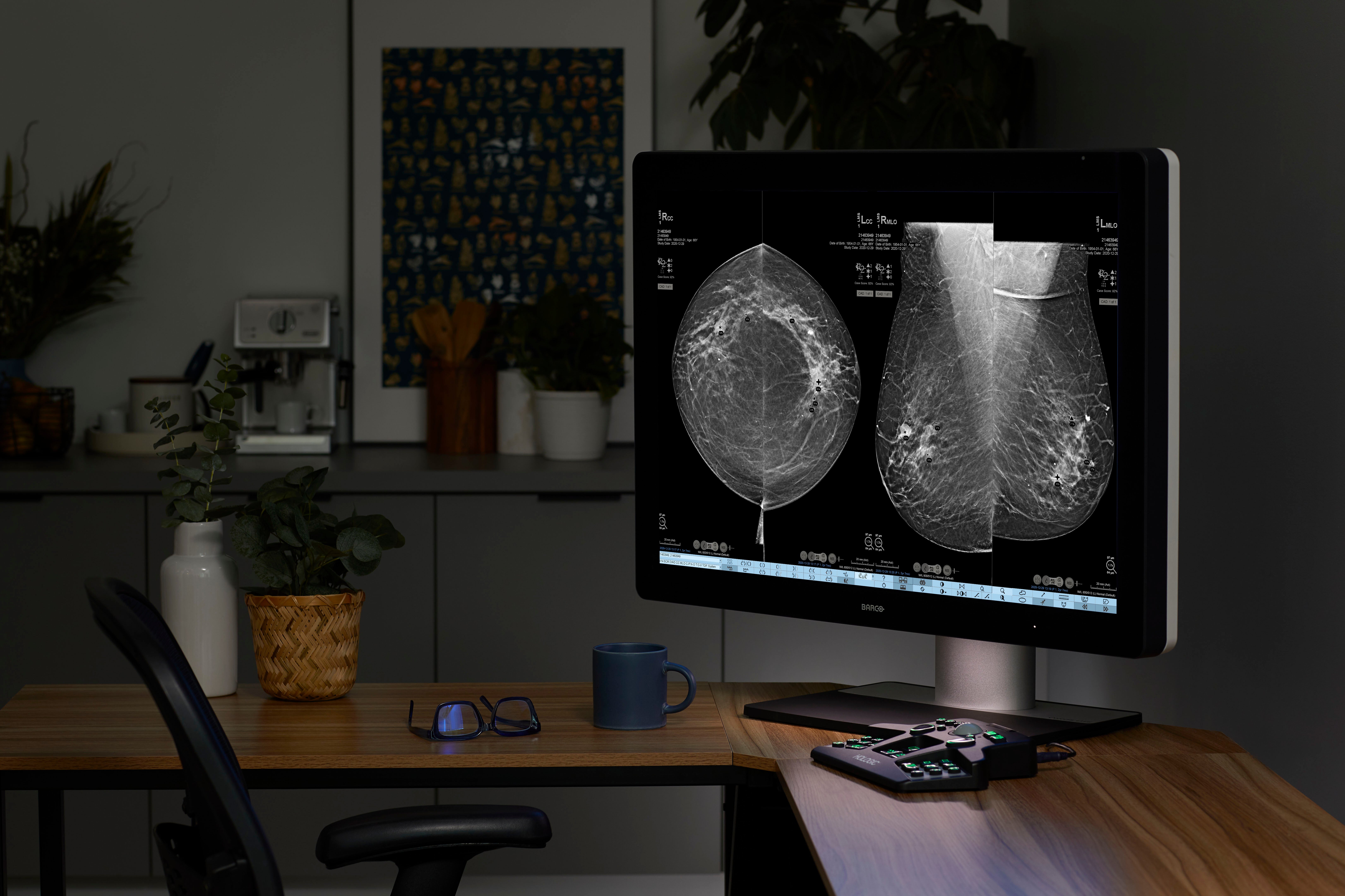 Hologic Expands Breast Health Portfolio With DL-Based Detection ...