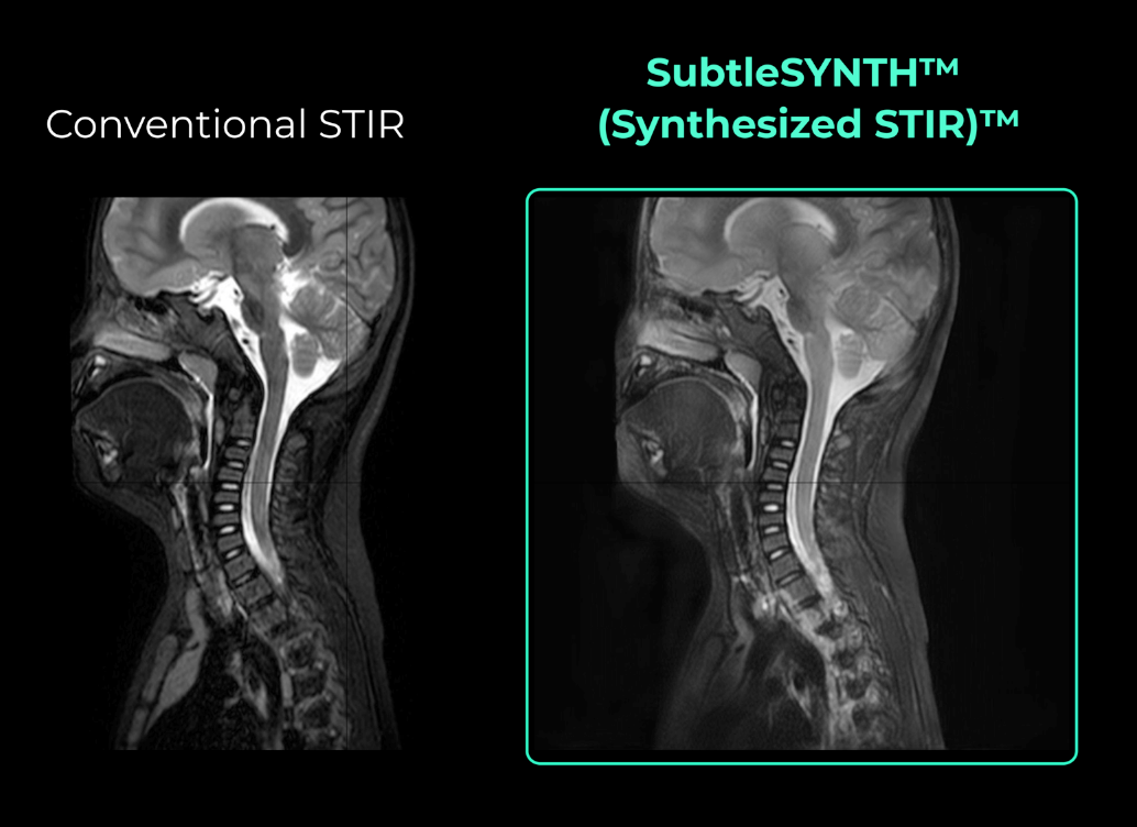 Subtle Medical Unveils New AI-Based Workflow Innovations | Applied ...