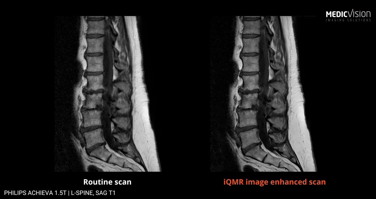Medic Vision Launches Short MRI Image Enhancement Software in the UK ...