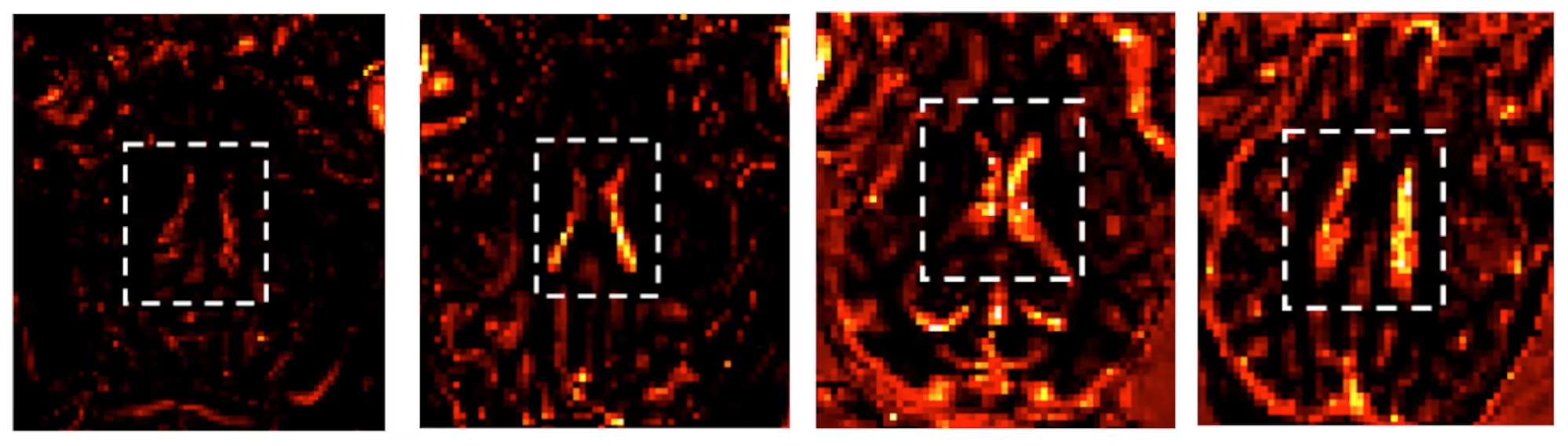 Researchers Use Macrophage-Adhering Gadolinium Micropatches to ...