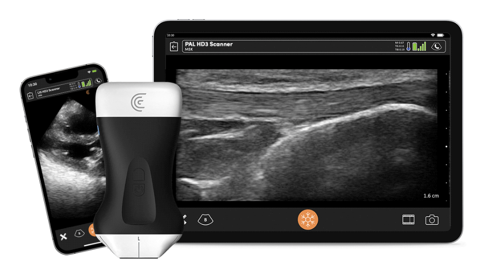 Clarius Receives CE Mark for Dual-Array Wireless Handheld Scanner ...