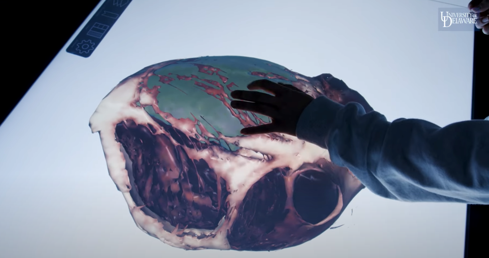 Students Use 3D Anatomy Tables for Clinical Learning | Applied Radiology