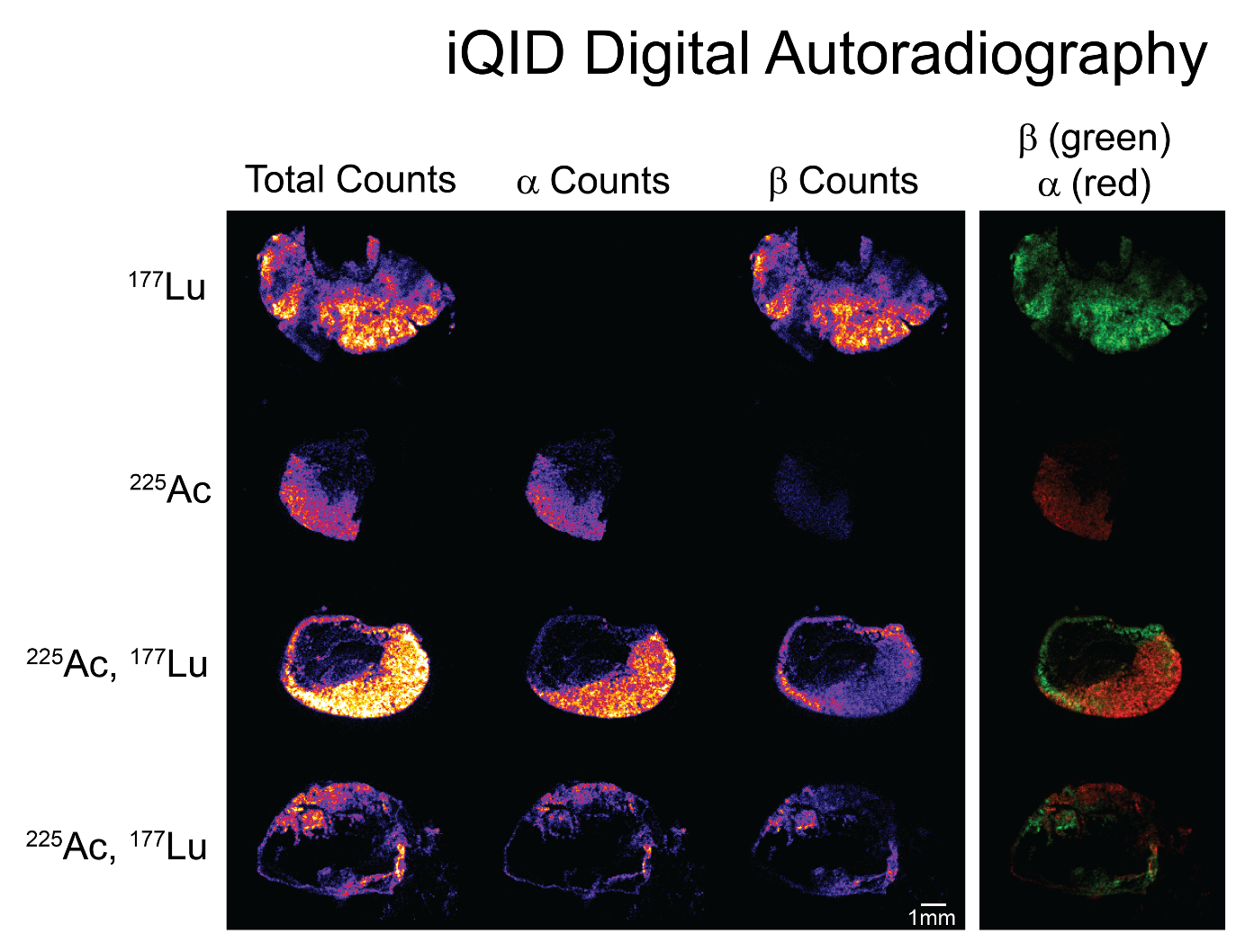Dual-Isotope Radionuclide Therapy Safe, Effective in Colorectal Cancer ...