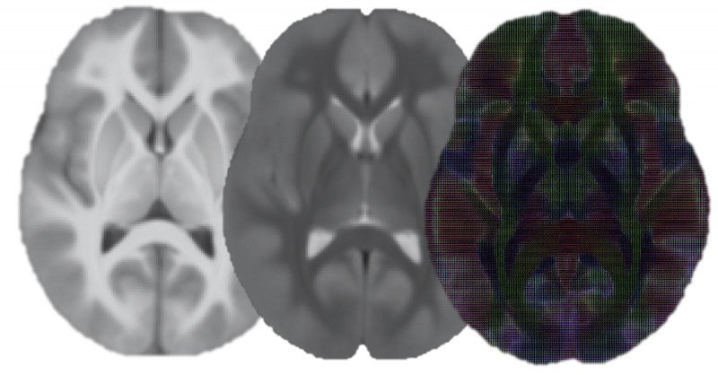 New Neuroimaging Analysis Approach Improves Cognition, Behavior ...