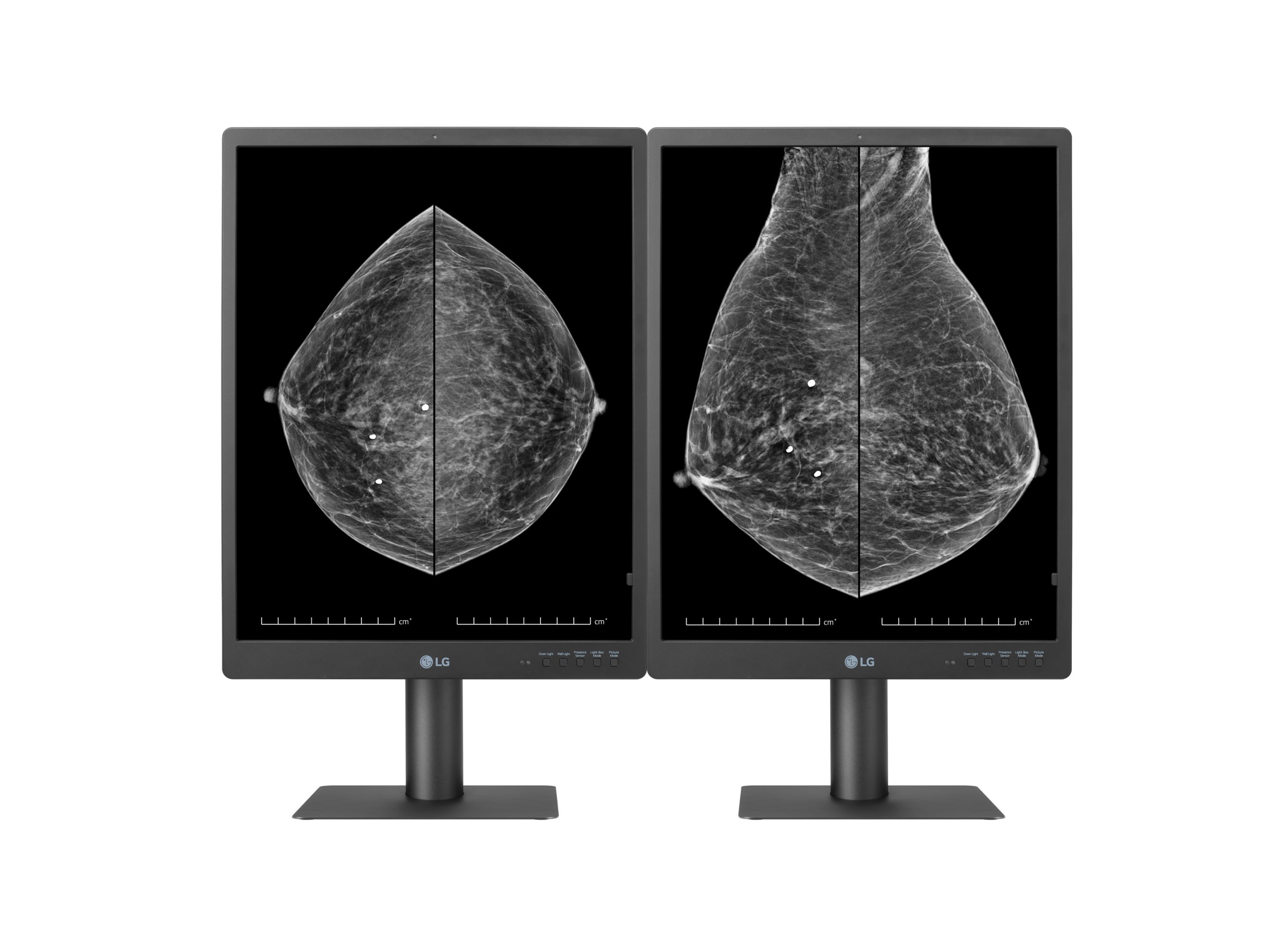 LG Introduces 5MP Diagnostic Monitor Designed for Digital Breast ...