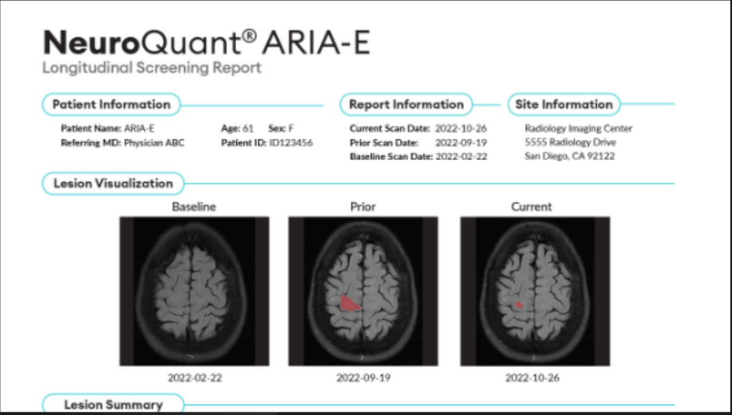 Cortechs.ai Nets FDA Clearance for NeuroQuant 5.0 with Improved ARIA ...