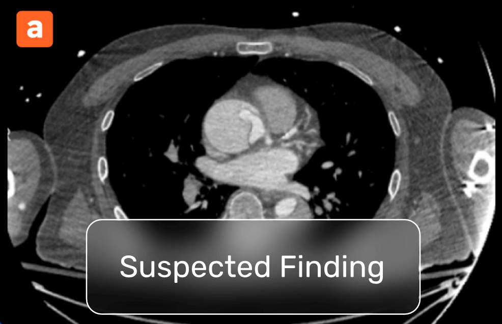 Aidoc Expands aiOS Platform with Seven New Algorithms | Applied Radiology