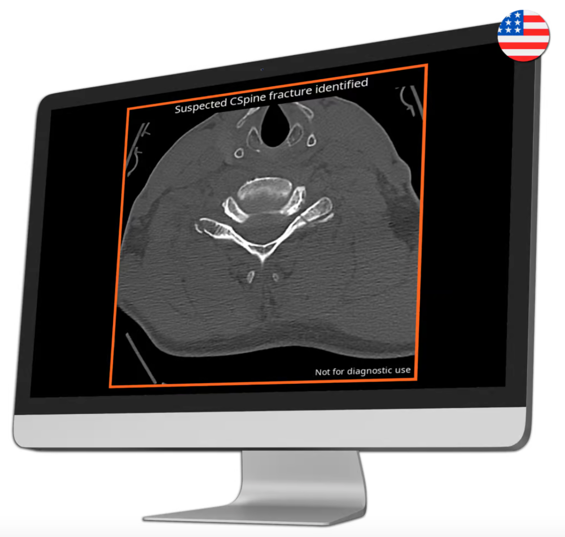 AI Tool to Detect C-Spine Fractures Gets FDA Clearance | Applied Radiology