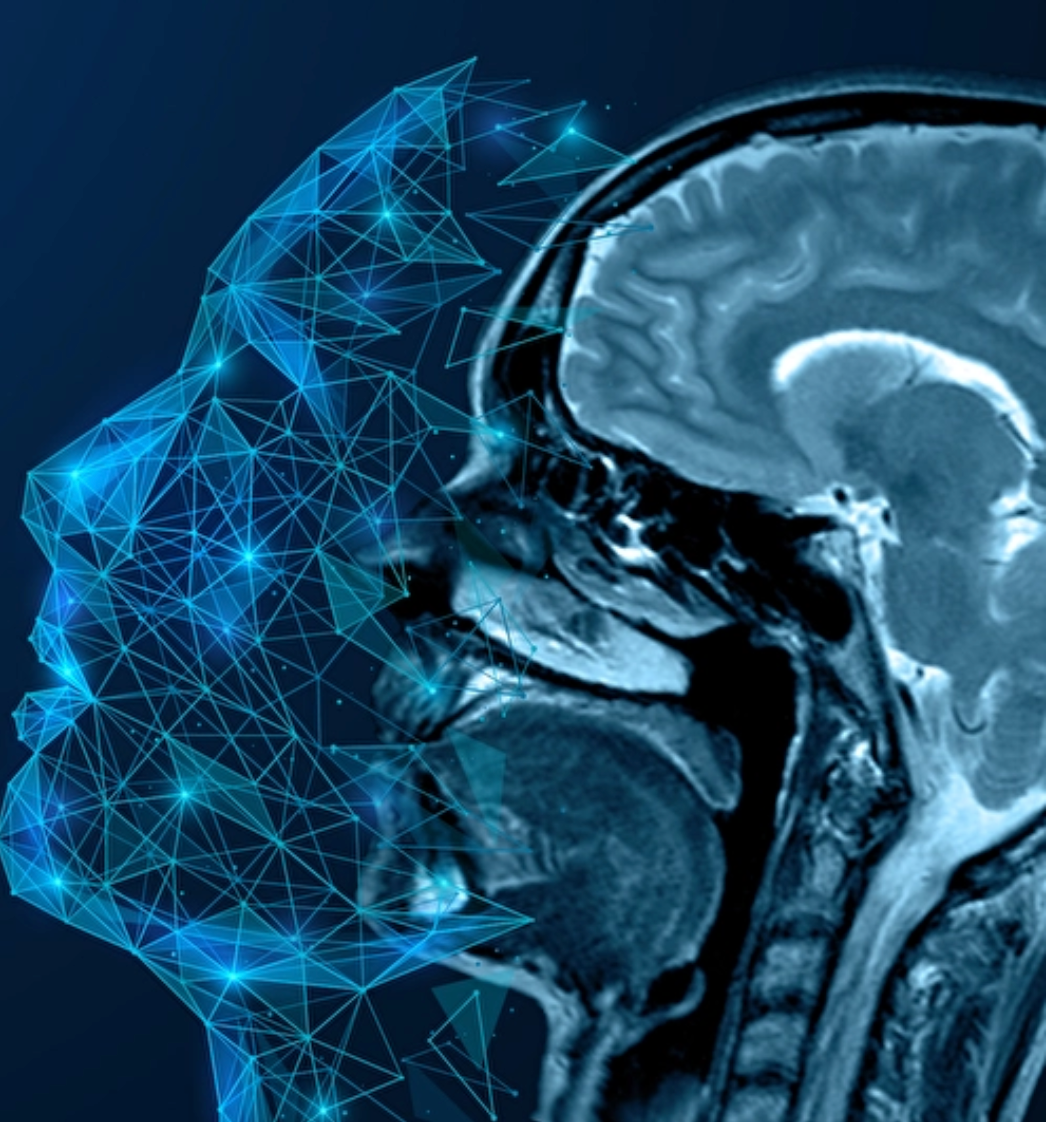 FDA Clears Bracco, Subtle Medical Collaborative AI-Powered, Brain MRI ...