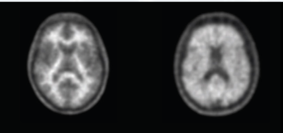 Life Molecular Imaging and SOFIE Expand Partnership to Increase ...