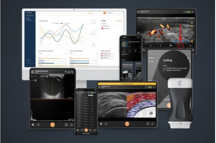 Clarius Releases New Ultrasound Software to Enhance Efficiency and User ...