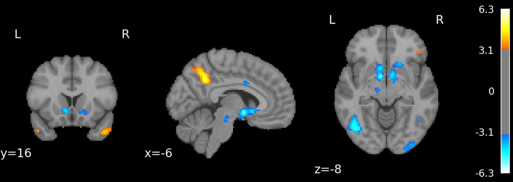 New Framework Finds Key Insights into the Brain’s Network Using fMRI ...