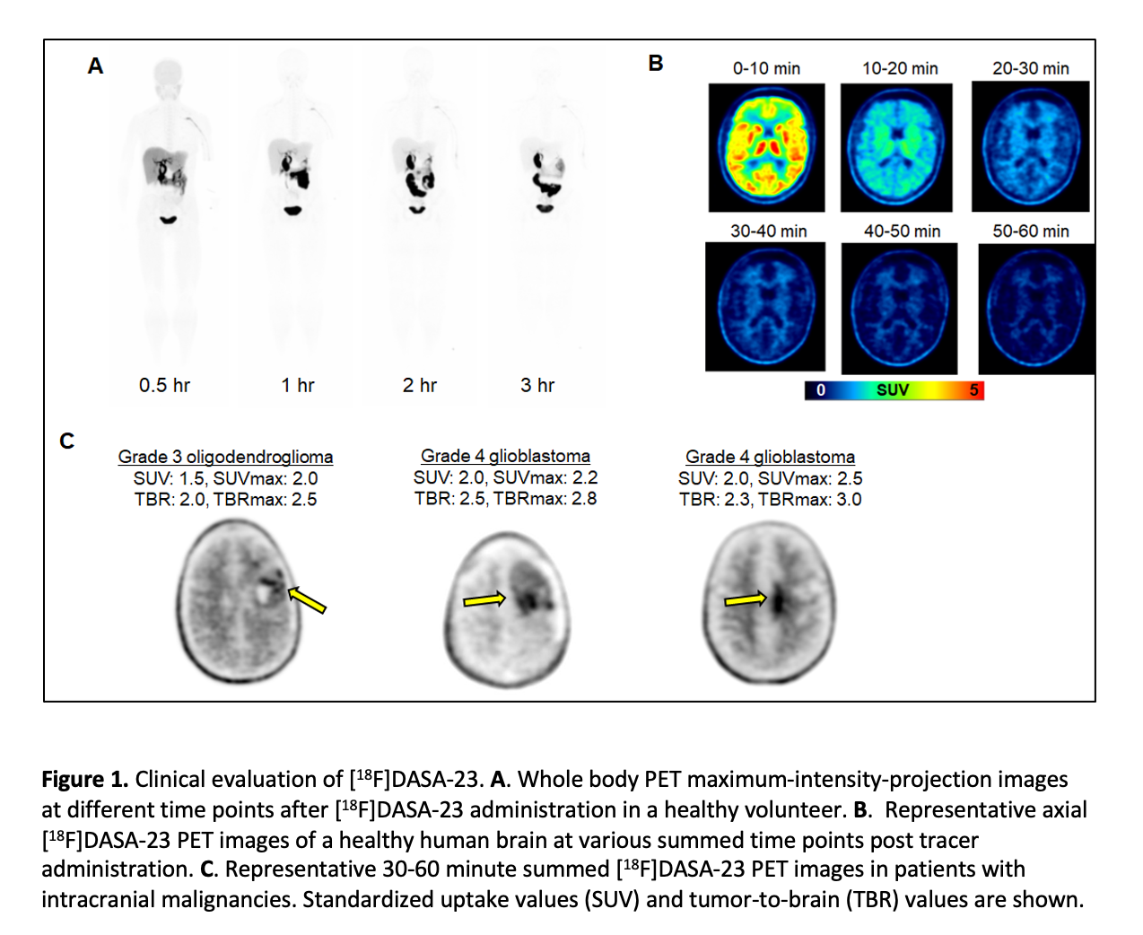 SNMMI ’21: Novel Radiopharmaceutical Tracks Protein Responsible for ...