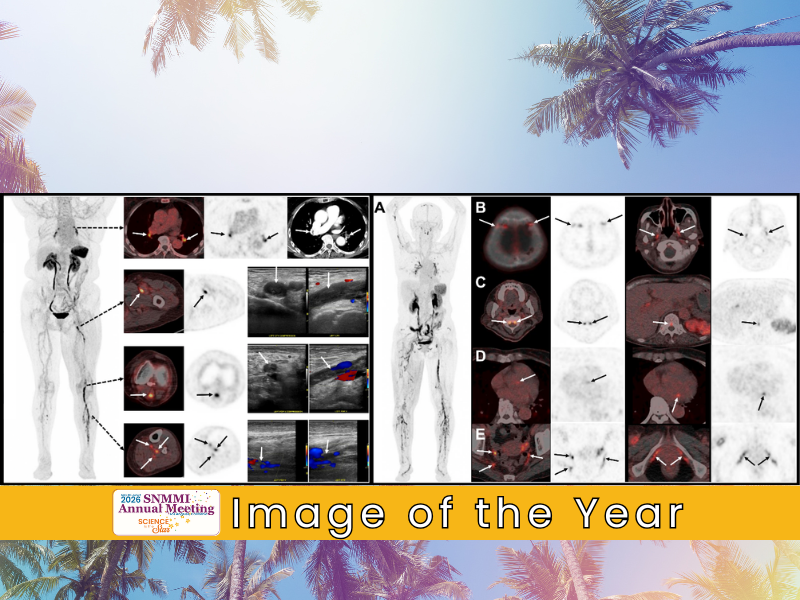 New Portable PET Scanner Enhances Real-Time Imaging for Interventional ...